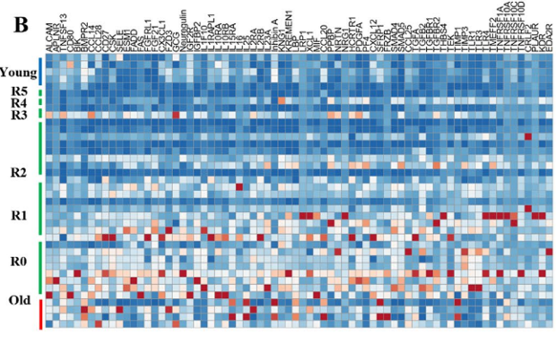 Therapeutic Plasma Exchange - Lifespan Edge
